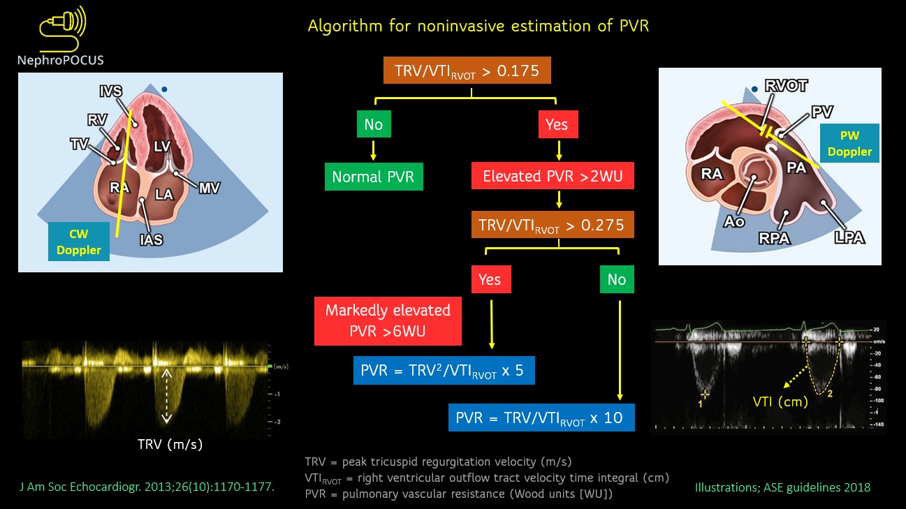 Infographics – NephroPOCUS